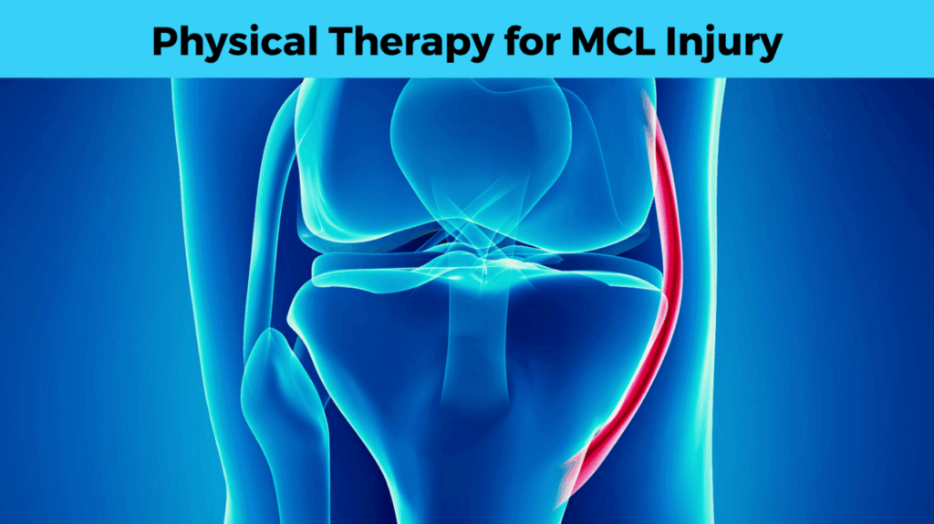 MCL Tear Medial Collateral Ligament Injuries A Comprehensive Guide ...