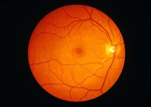 Fluid Behind the Retina A Comprehensive Guide | Health & Style Plus