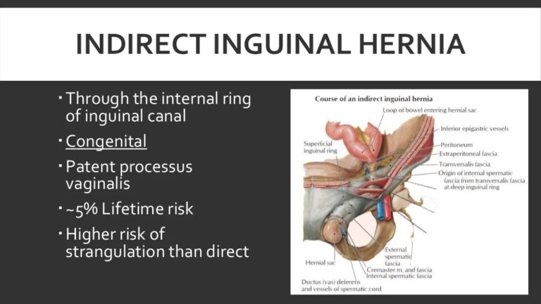 Direct vs Indirect Hernia A Comprehensive Guide | Health & Style Plus