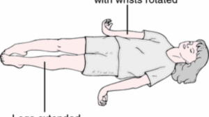 Decorticate vs Decerebrate Posturing A Deep Dive | Health & Style Plus