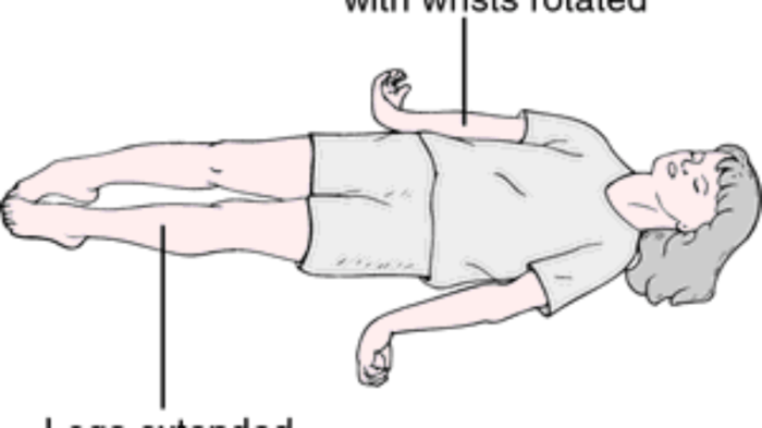 Decorticate vs Decerebrate Posturing A Deep Dive | Health & Style Plus